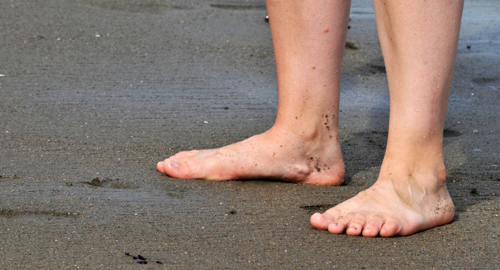 Understanding Flat Feet: Causes, Symptoms, and Treatment Options – Fits ...